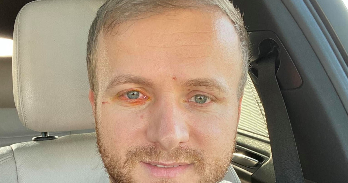 Cine este Daniel Bodnar, activistul de mediu aflat în stare gravă în ...