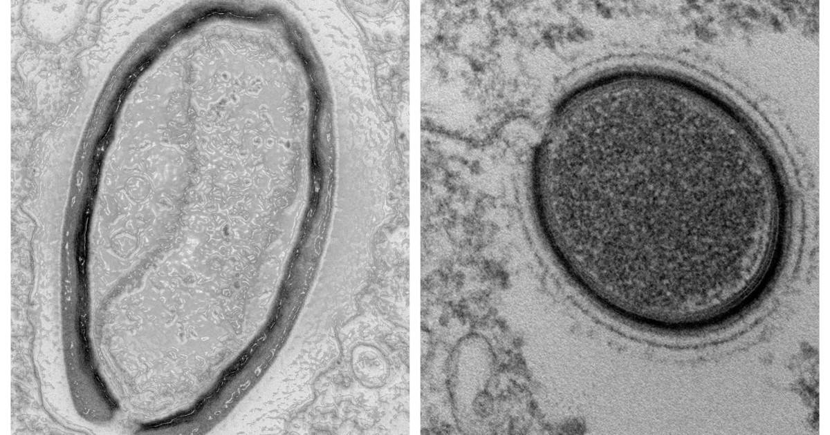 De ce a fost înviat un „virus zombie” vechi de 50.000 de ani și cât de ...