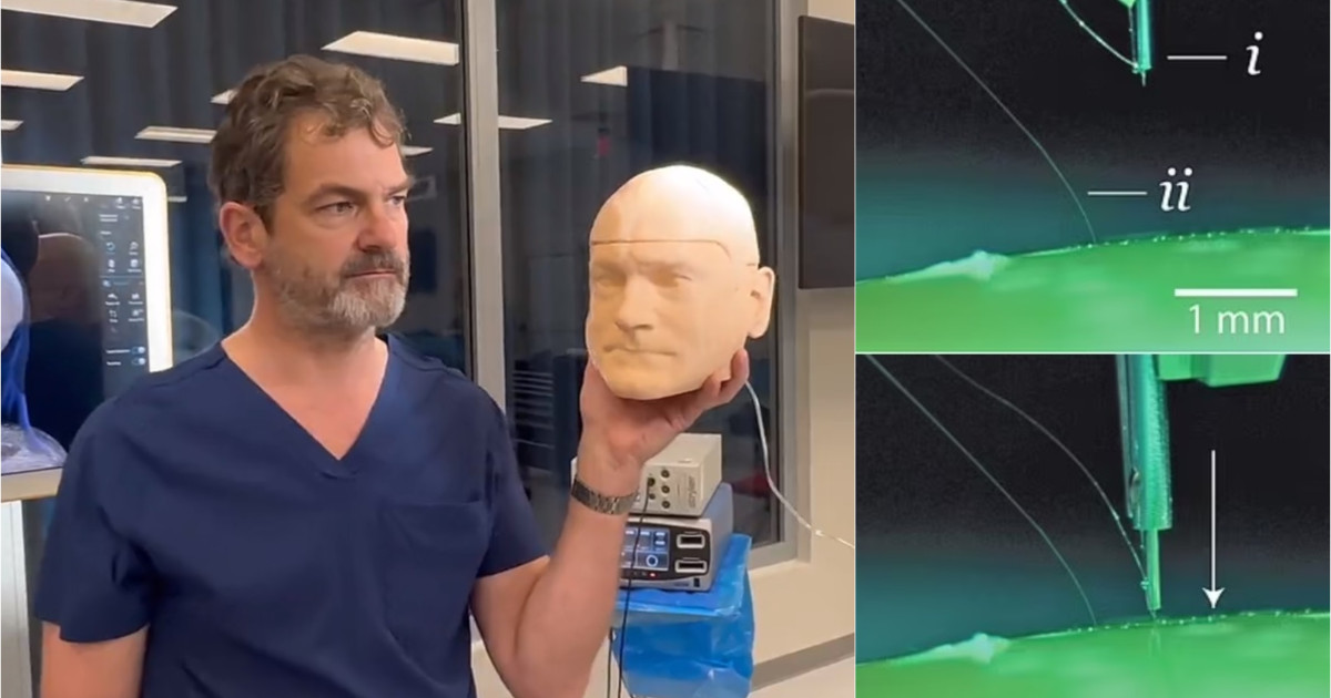 Ce se întâmplă dacă ți se implantează în creier cipul Neuralink al lui ...