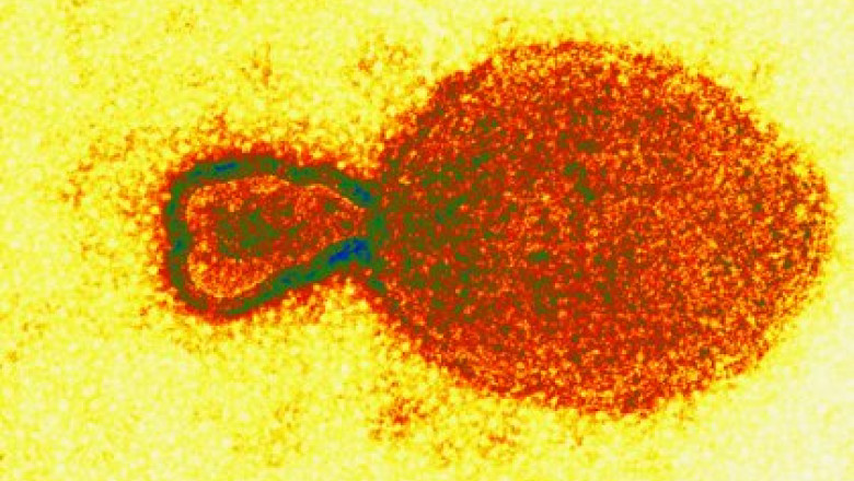 Grav incident de biosecuritate: sute de mostre de virusuri periculoase ...
