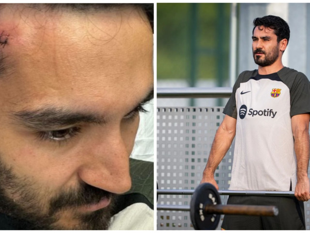 ”Încheie anul cu copci!” Starul Barcelonei și-a spart capul în timpul ...