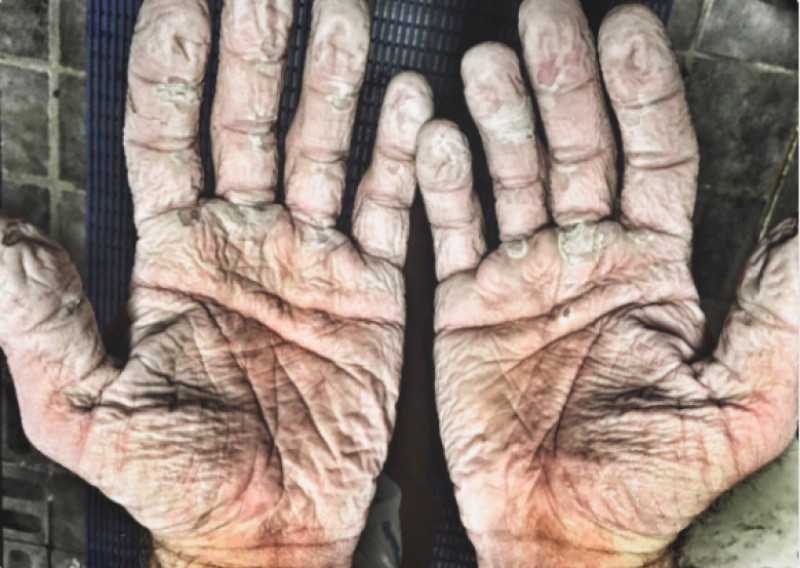 Poza cu mâinile unui olimpic la canotaj a devenit virală